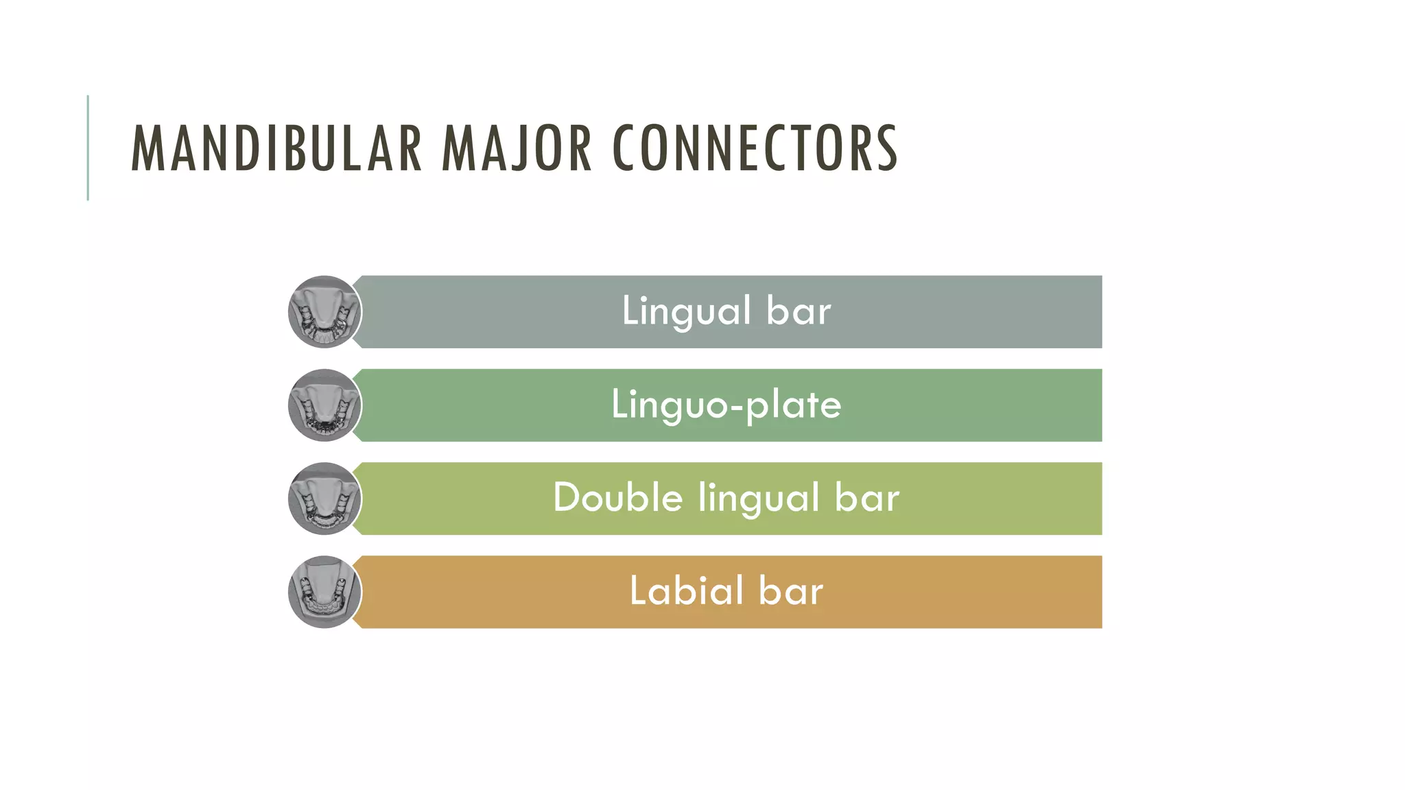 Mandibular Major Connectors | PDF