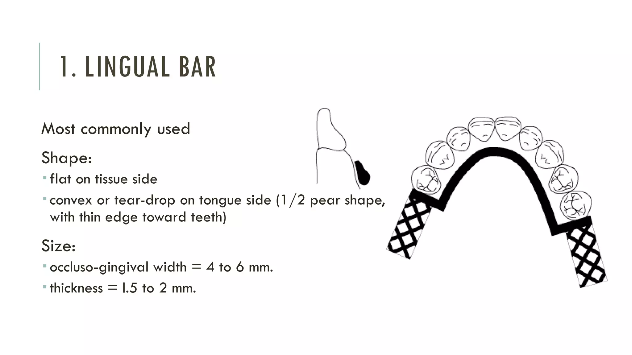 Mandibular Major Connectors | PDF