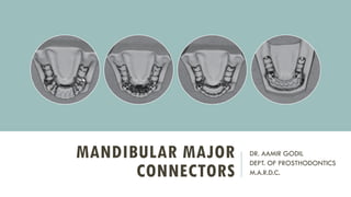 Mandibular Major Connectors | PDF