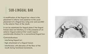 Mandibular Major Connectors | PDF