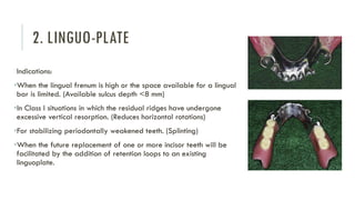 Mandibular Major Connectors | PDF