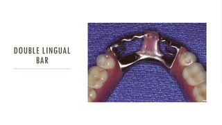 Mandibular Major Connectors | PDF
