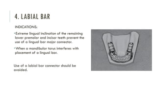 Mandibular Major Connectors | PDF