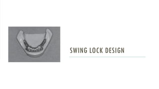 Mandibular Major Connectors | PDF