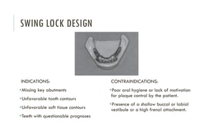 Mandibular Major Connectors | PDF