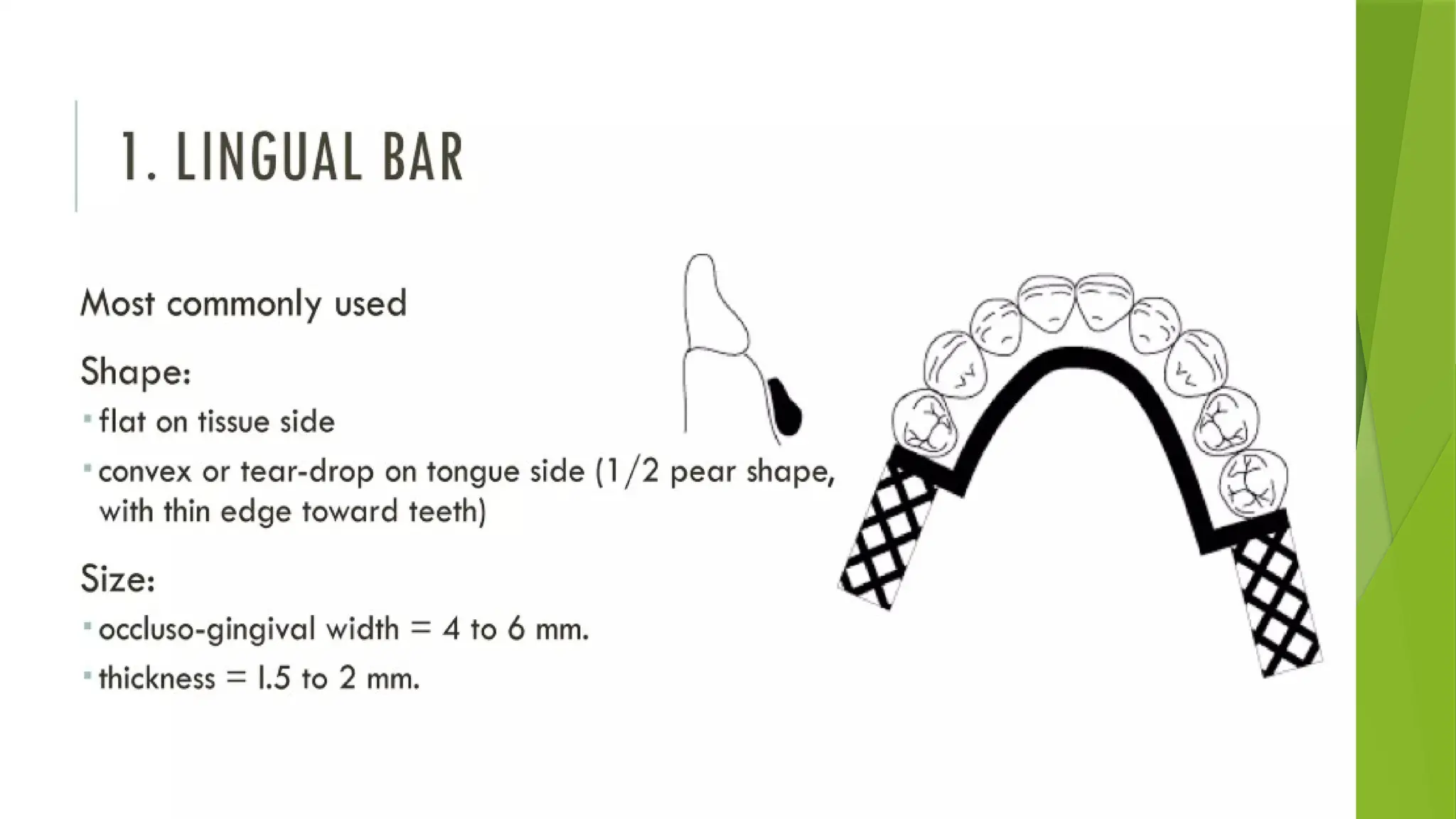 Mandibular Major Connectors Powerpoint Presentation | PPT
