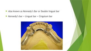 Mandibular Major Connectors Powerpoint Presentation | PPTX