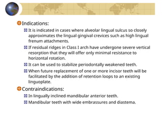 Mandibular Major Connectors1.ppt