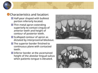 Mandibular Major Connectors1.ppt