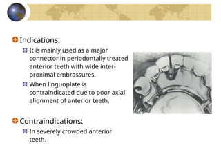 Mandibular Major Connectors1.ppt