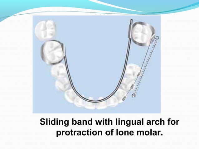 Mandibular molar protraction | PPT | Oral care | Personal Care