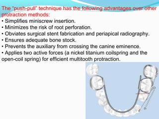 Mandibular molar protraction | PPT