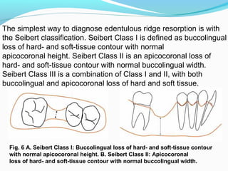 Mandibular molar protraction | PPT