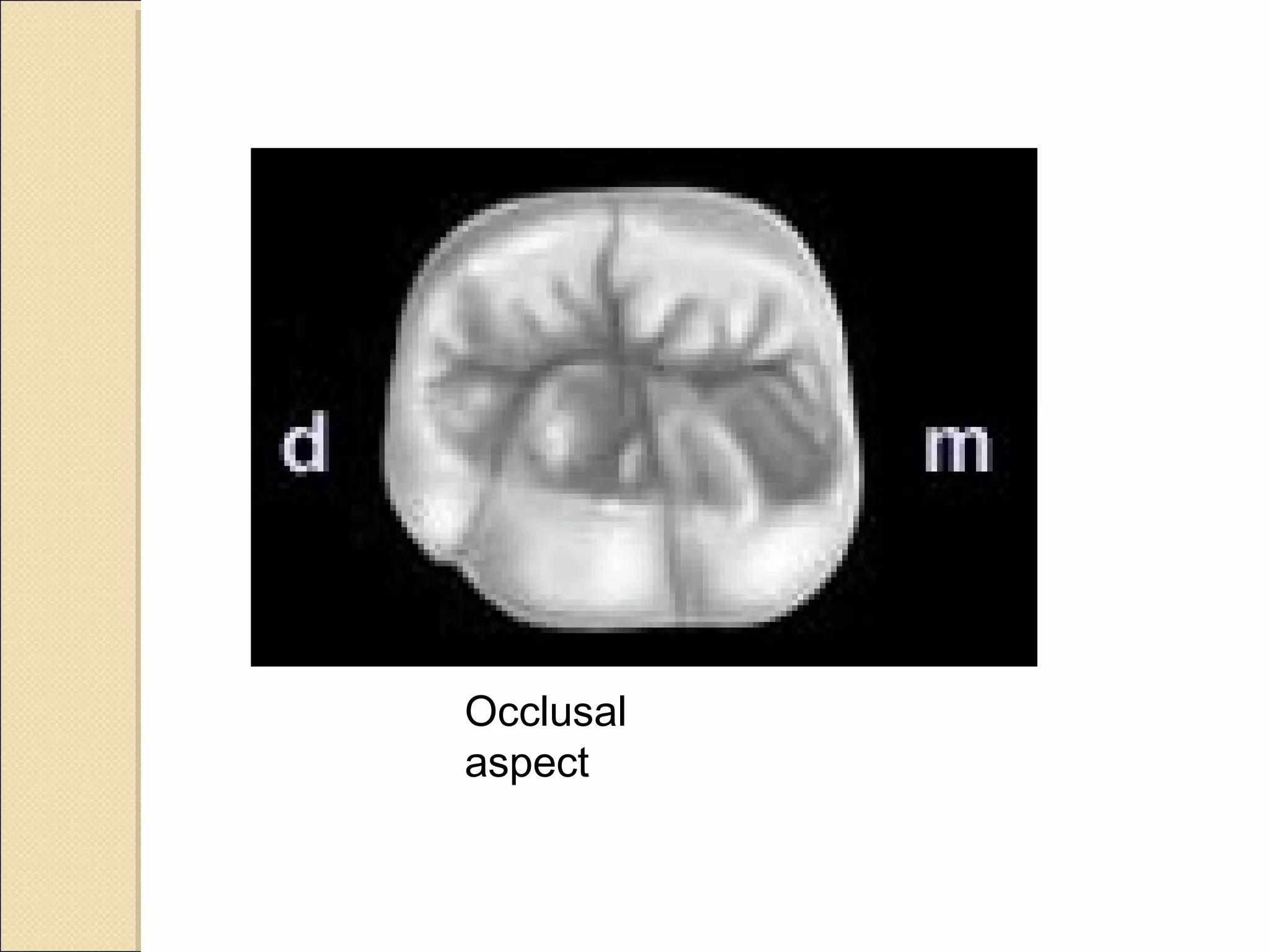 morphology of mandibular 1st,2nd,3rd molars teeth | PPT