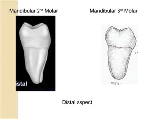 morphology of mandibular 1st,2nd,3rd molars teeth | PPT