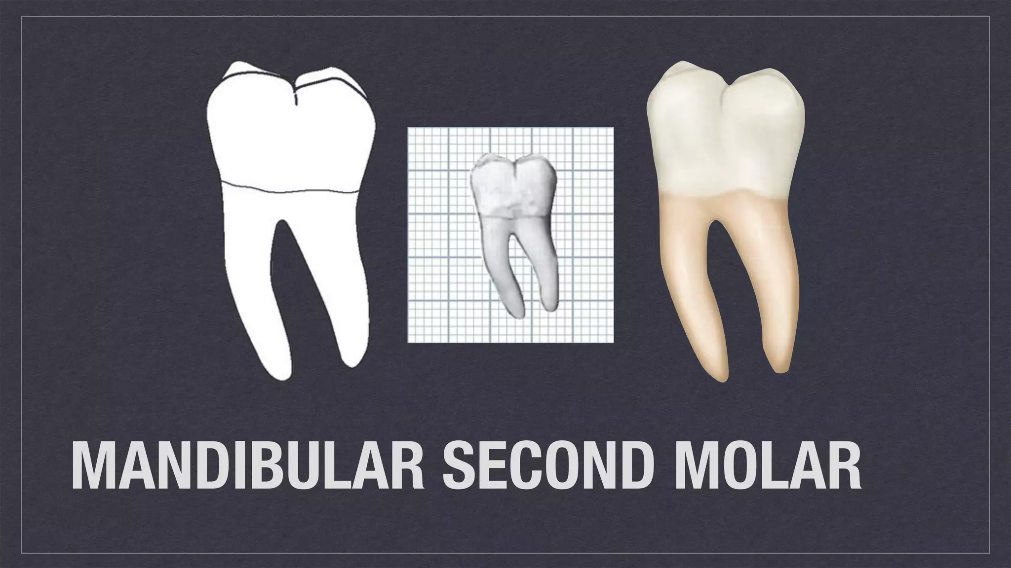 Mandibular molars | PPT