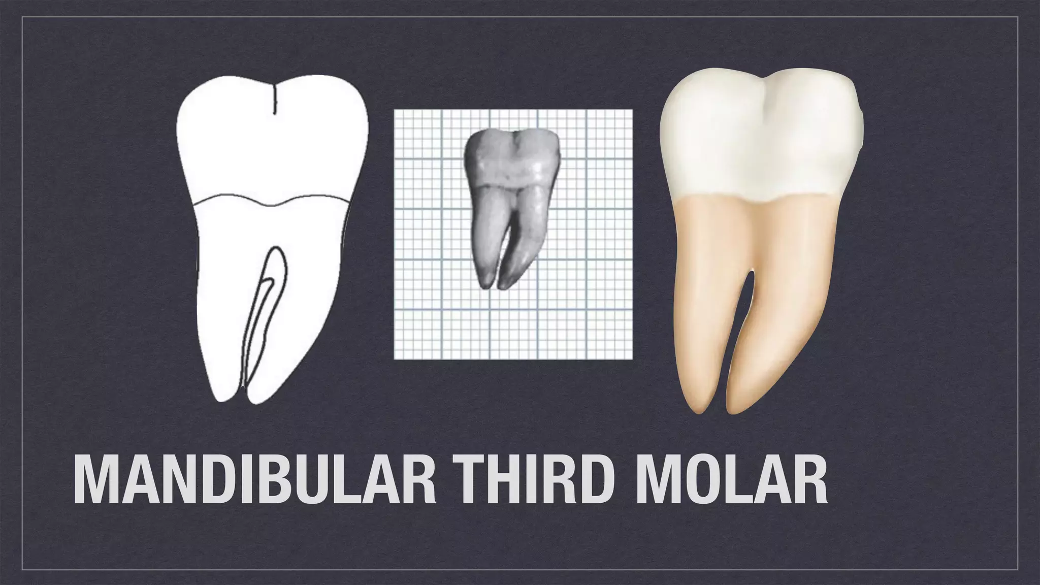 Mandibular molars | PPT