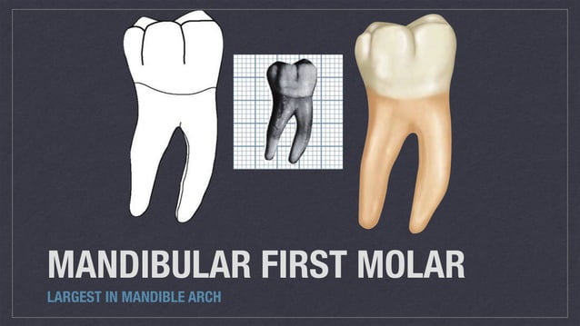 Mandibular molars | PPT