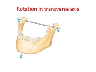 Mandibular movement | PPTX