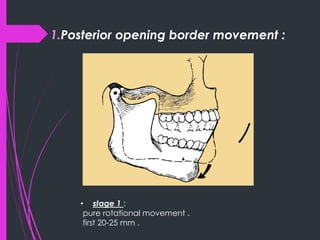 mechanics of Mandibular movement | PPTX