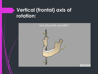 mechanics of Mandibular movement | PPTX