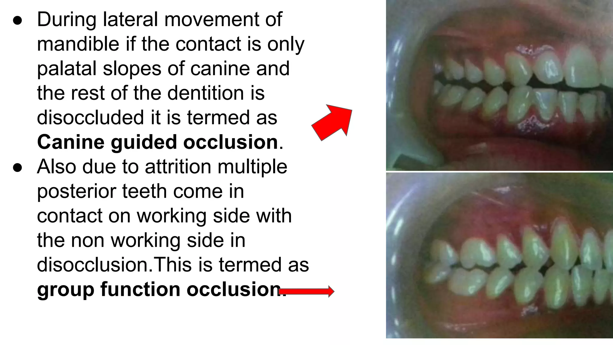 Mandibular movements in rpd | PPTX
