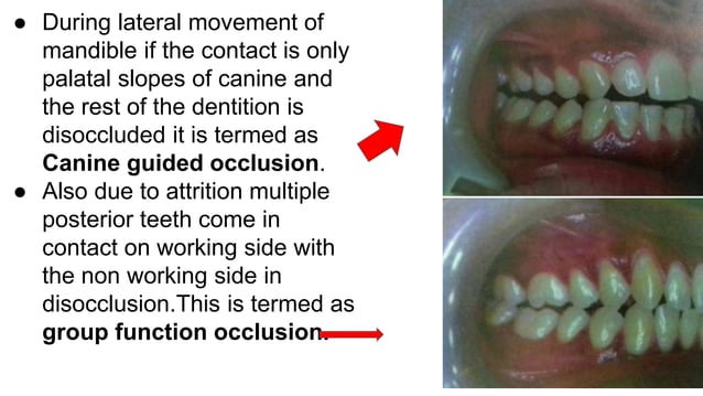Mandibular movements in rpd | PPTX