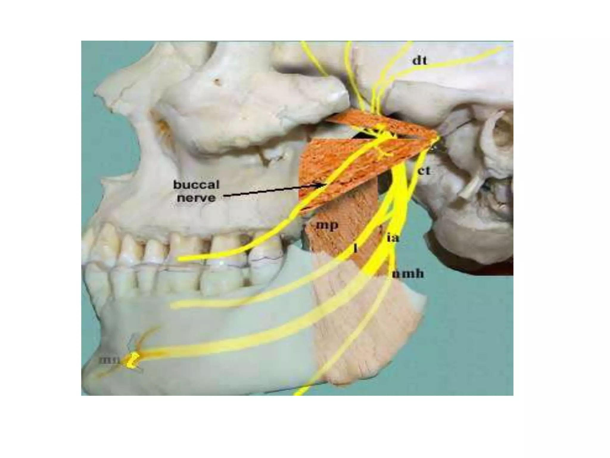 Mandibular nerve | PPTX