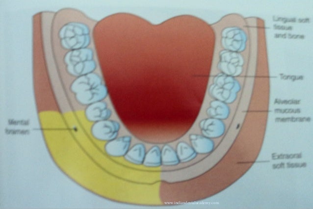 Mandibular nerve block and mental nerve / oral surgery courses