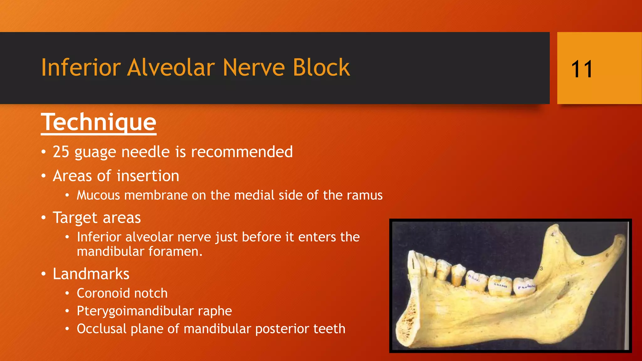 Mandibular nerve blocks | PPTX