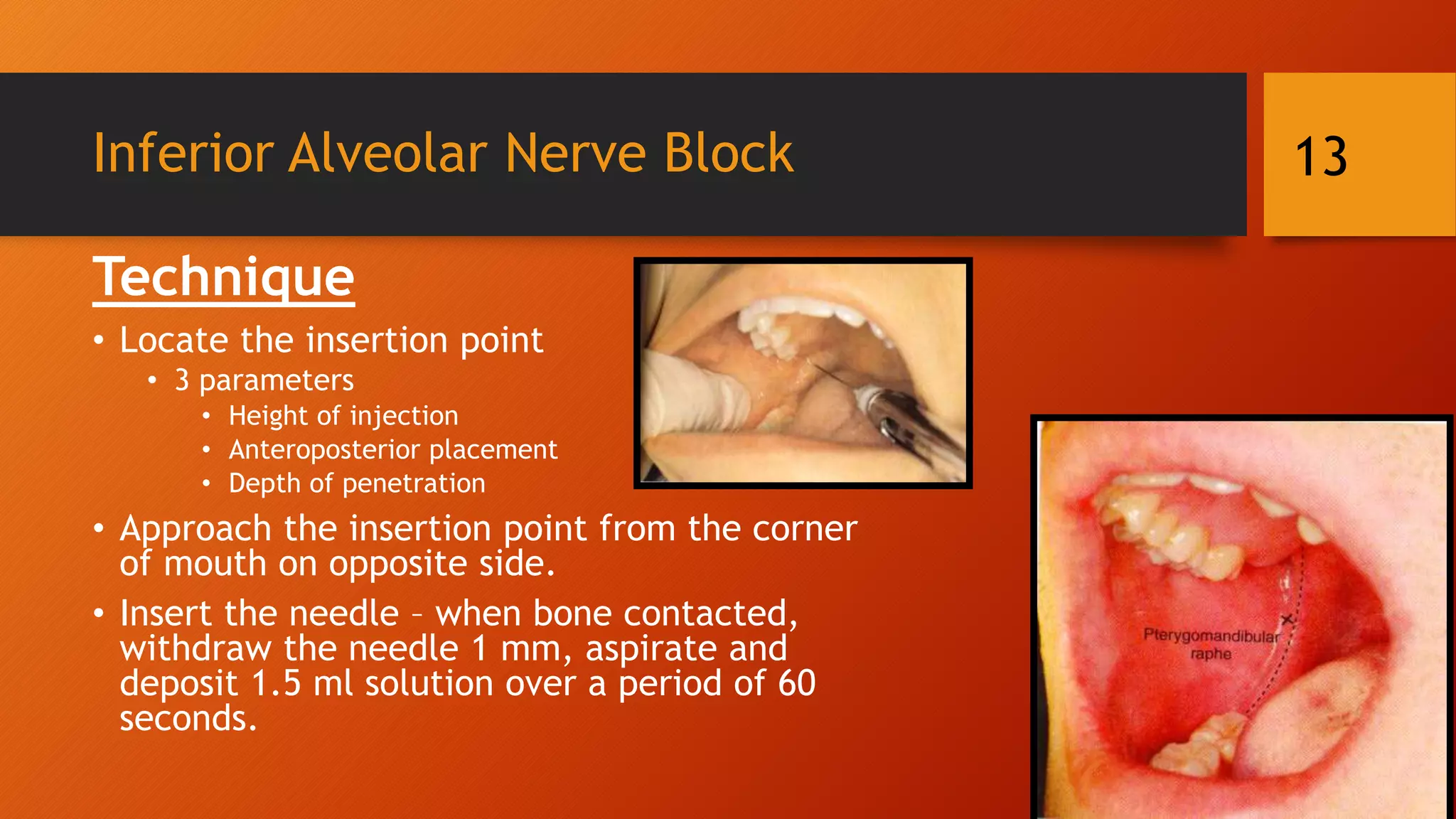 Mandibular nerve blocks | PPTX