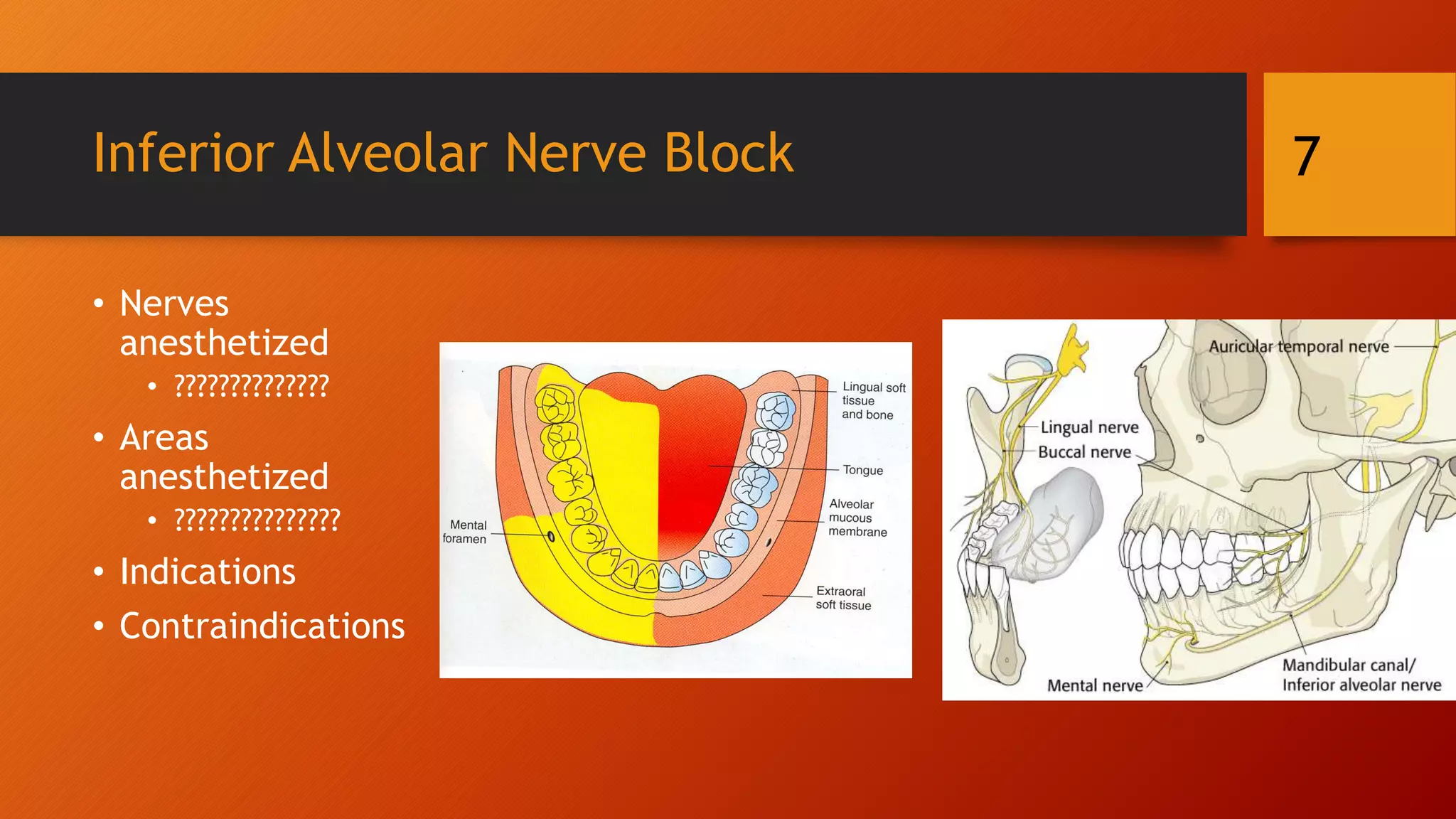 Mandibular nerve blocks | PPTX