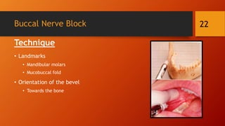 Mandibular nerve blocks | PPTX