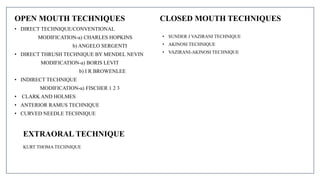 MANDIBULAR NERVE BLOCKS and techniques in dentistry | PPTX