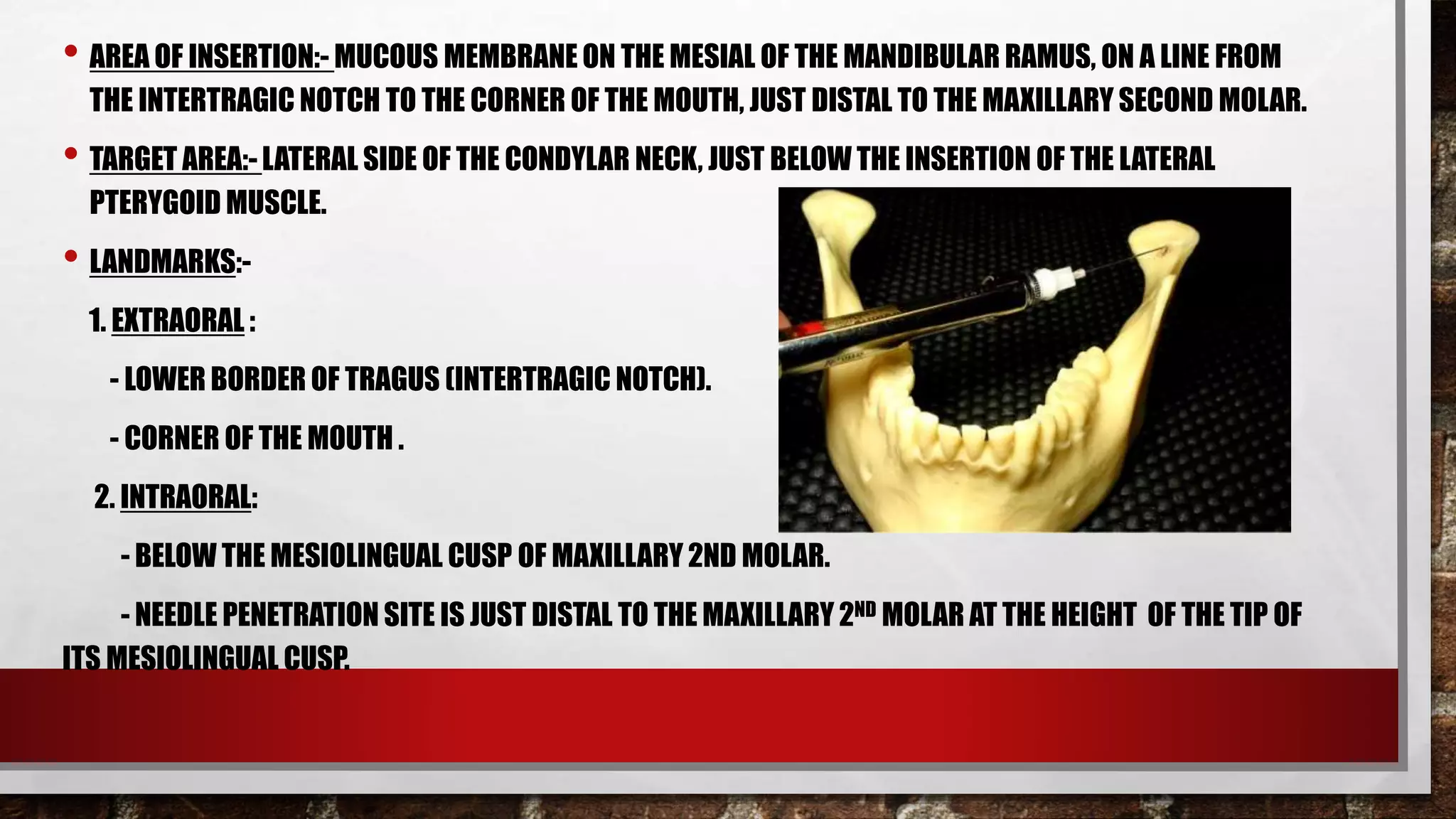MANDIBULAR NERVE BLOCK TECHNIQUES | PPTX
