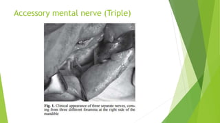 Anatomical variations of Mental nerve | PPTX