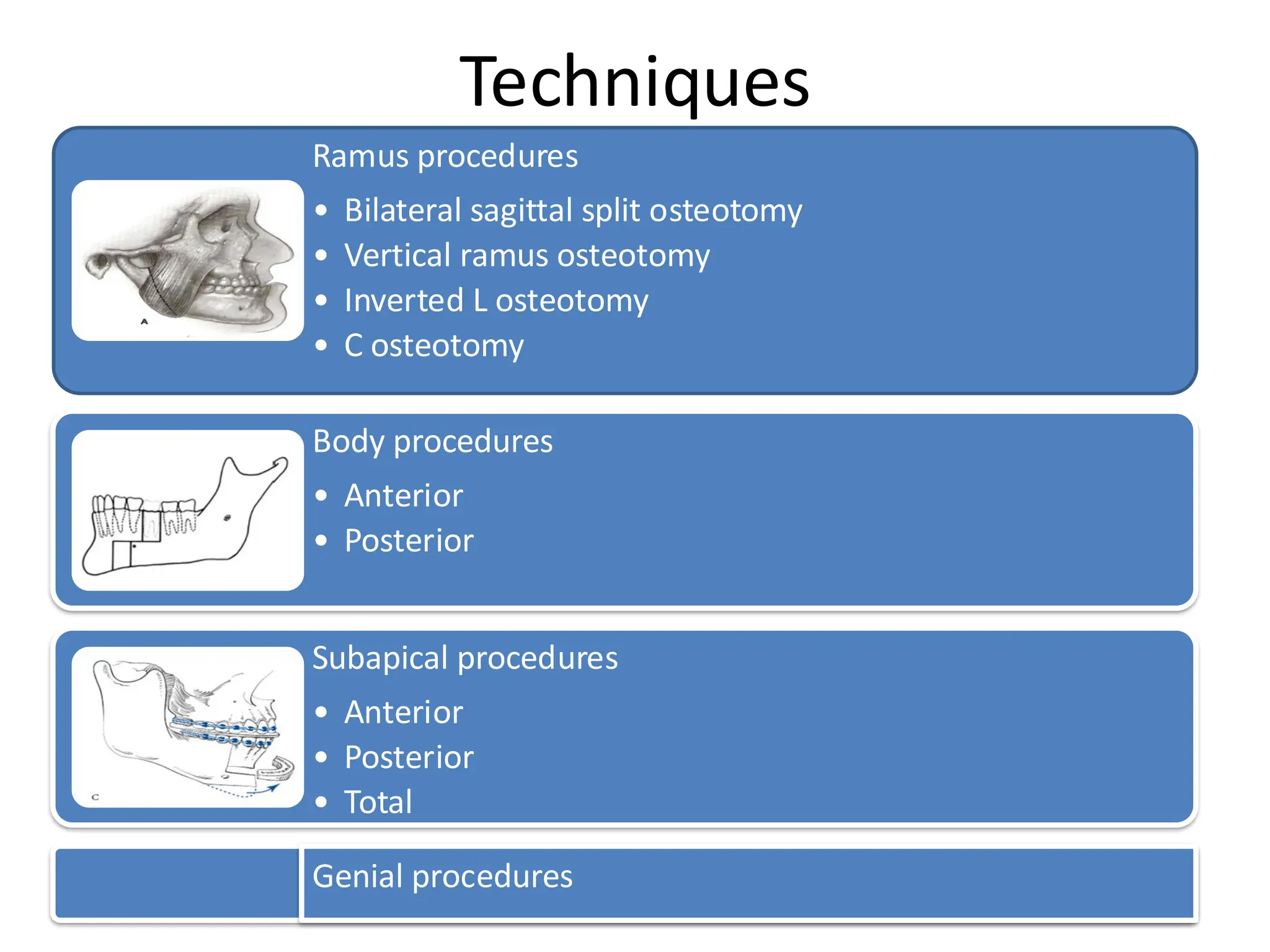 Mandibular orthognathic procedures oral surgery | PDF
