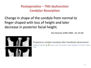 mandibular orthognathic procedures II- ih | PPTX