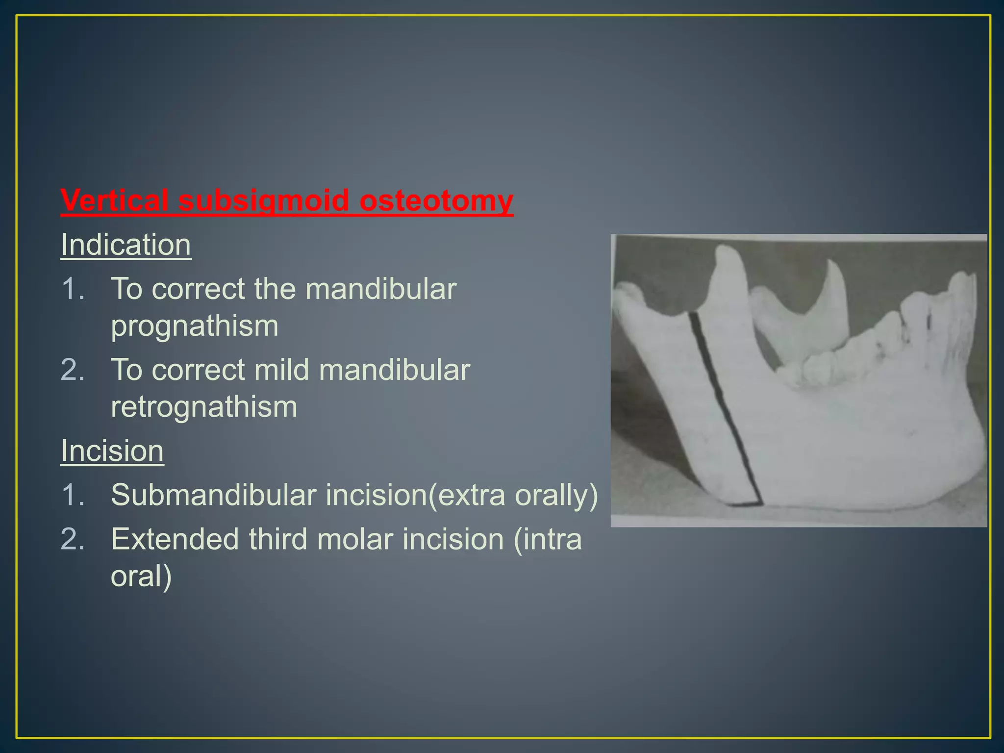 MANDIBULAR OSTEOTOMIES.pptx
