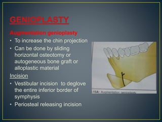 MANDIBULAR OSTEOTOMIES.pptx