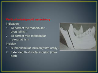 MANDIBULAR OSTEOTOMIES.pptx