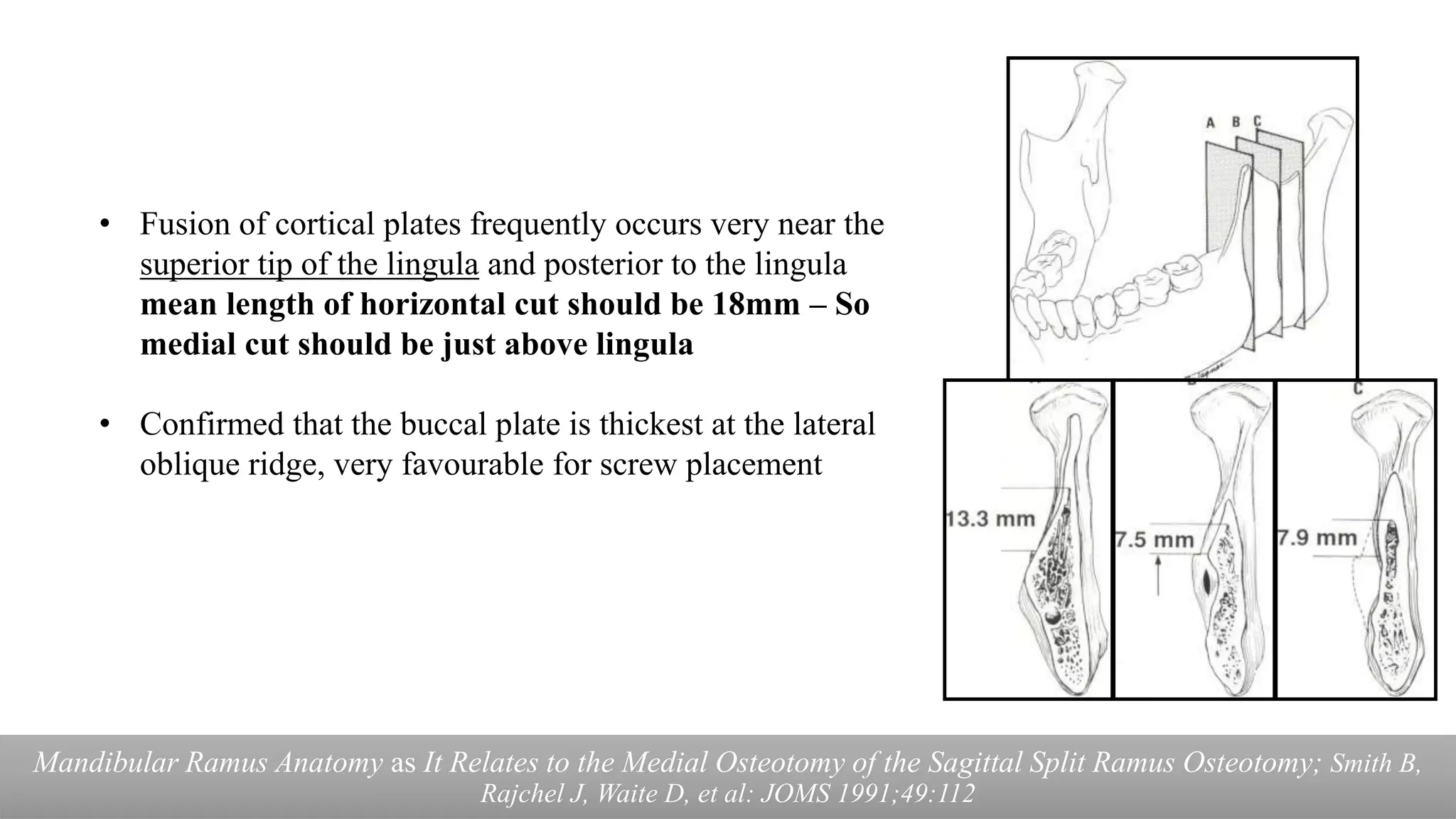Mandibular osteotomies.pptx