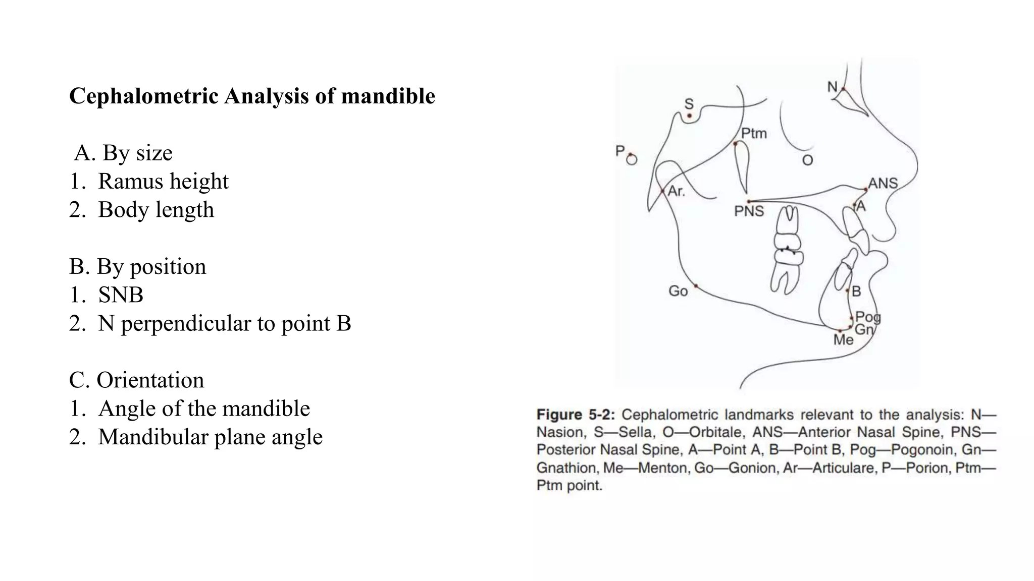 Mandibular osteotomies.pptx