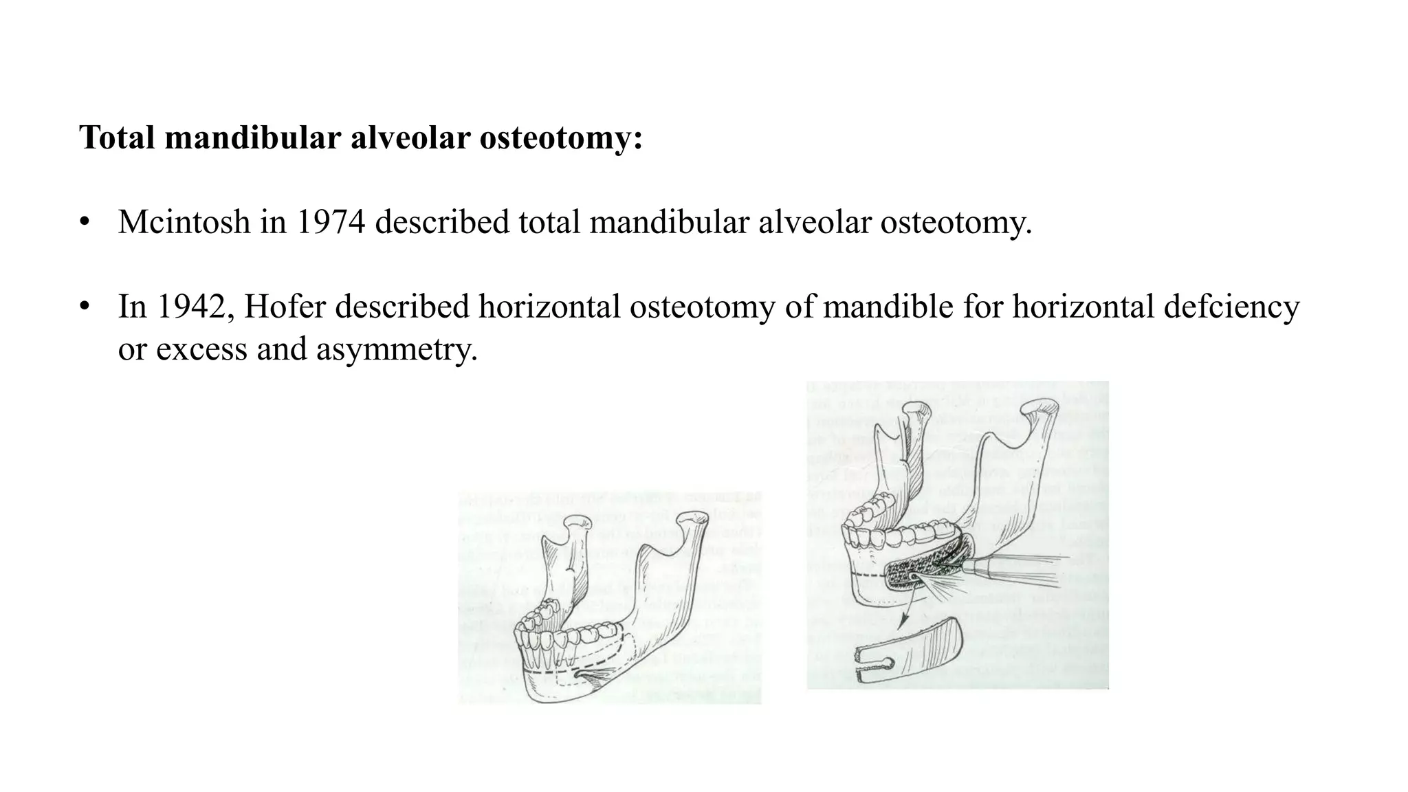 Mandibular osteotomies.pptx