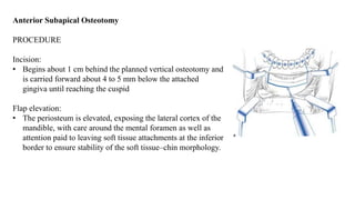 Mandibular osteotomies.pptx