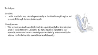 Mandibular osteotomies.pptx