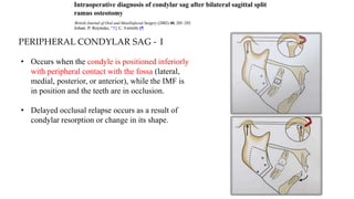 Mandibular osteotomies.pptx