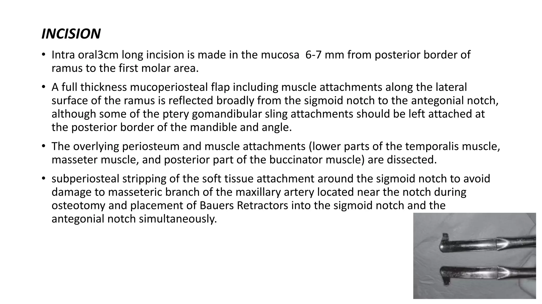Mandibular osteotomy and genioplasty | PPTX