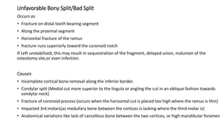 Mandibular osteotomy and genioplasty | PPTX