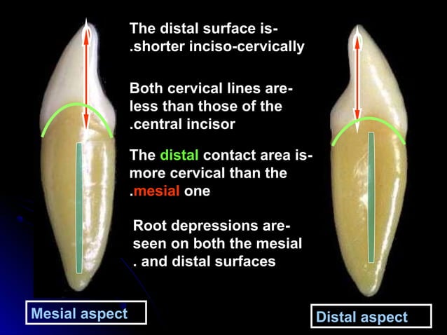 Mandibular permanent incisors | PPT